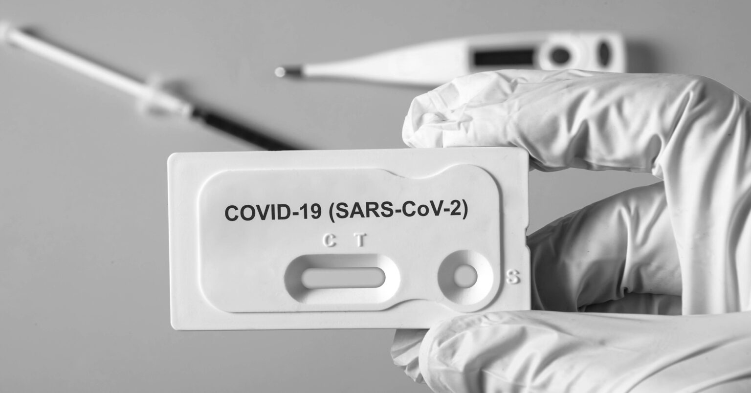 Philippines FDA sets new COVID-19 test kit performance limits